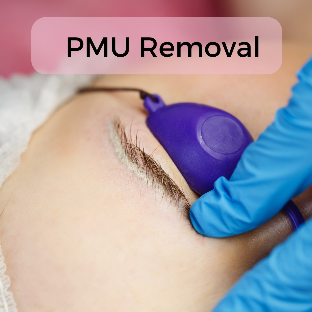 Erase and Embrace Tattoo Removal – Erase the Past, Embrace the Future ...